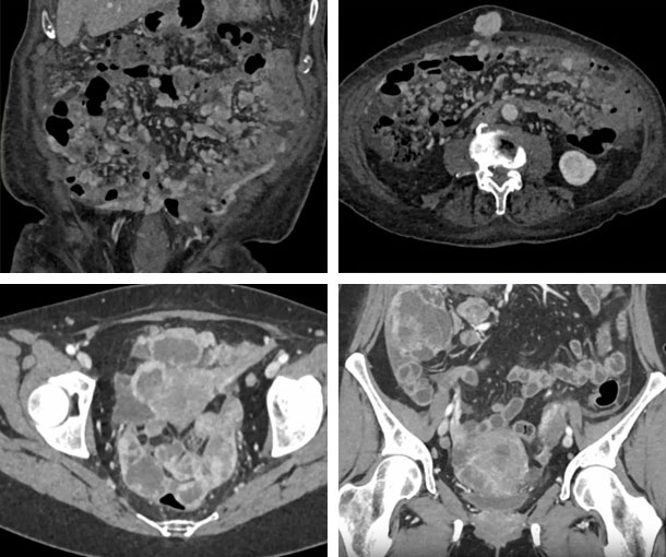 CT Quick Guides - CTisus.com CT Scanning