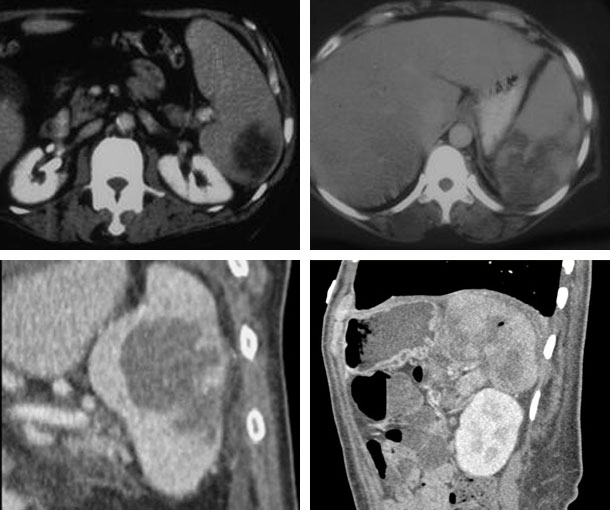 CT Quick Guides - CTisus.com CT Scanning
