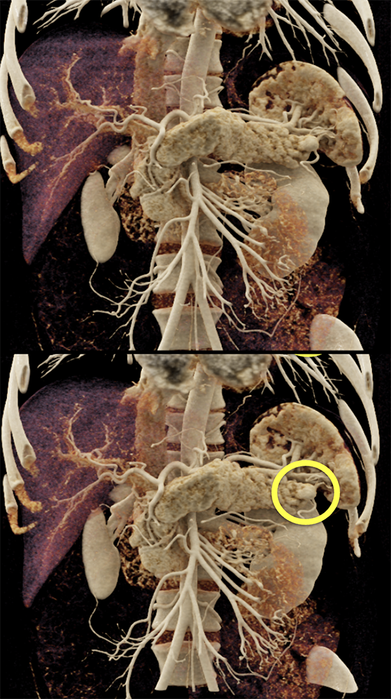 Gastrointestinal - Learning Modules - CTisus.com CT Scanning