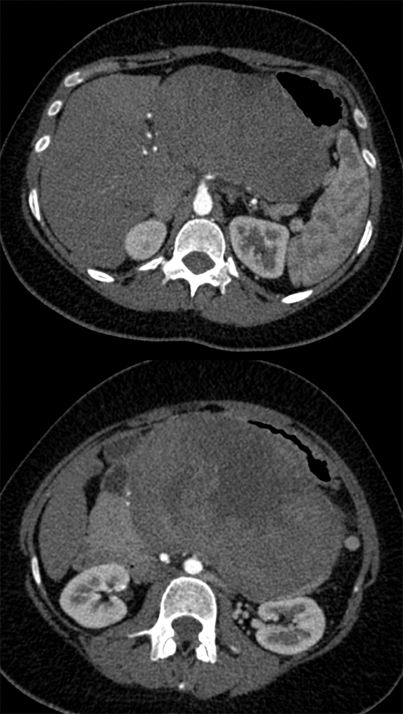 Gastrointestinal - Learning Modules - CTisus.com CT Scanning