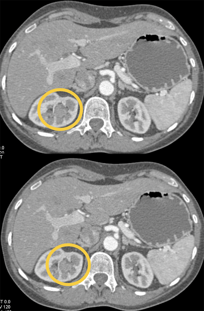 Genitourinary - Learning Modules - CTisus.com CT Scanning