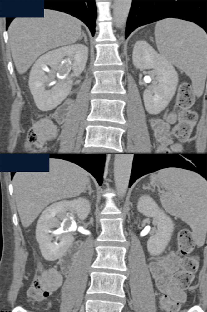 Genitourinary - Learning Modules - CTisus.com CT Scanning