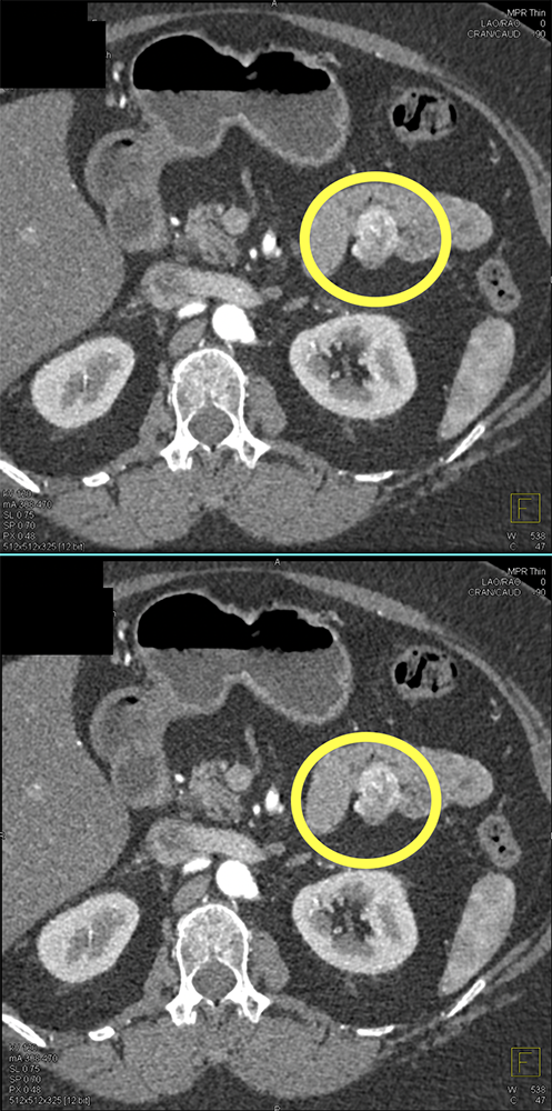 Gastrointestinal - Learning Modules - CTisus.com CT Scanning