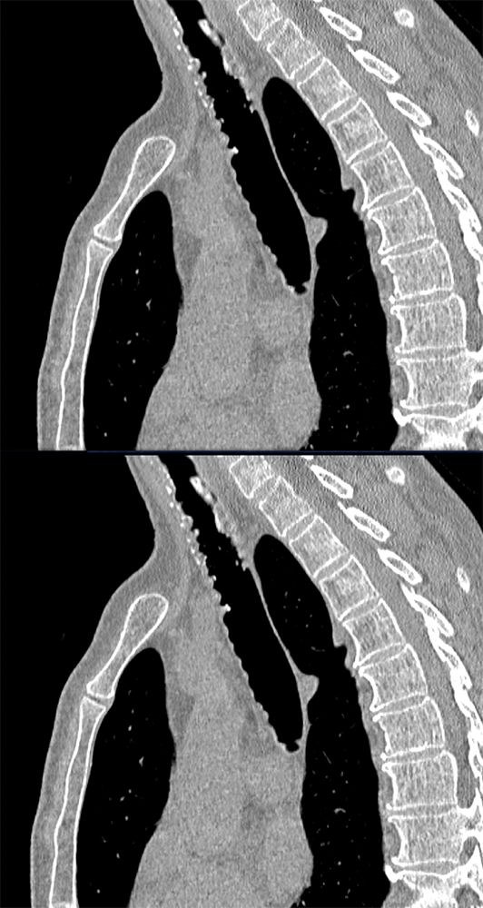 Chest - Learning Modules - CTisus.com CT Scanning