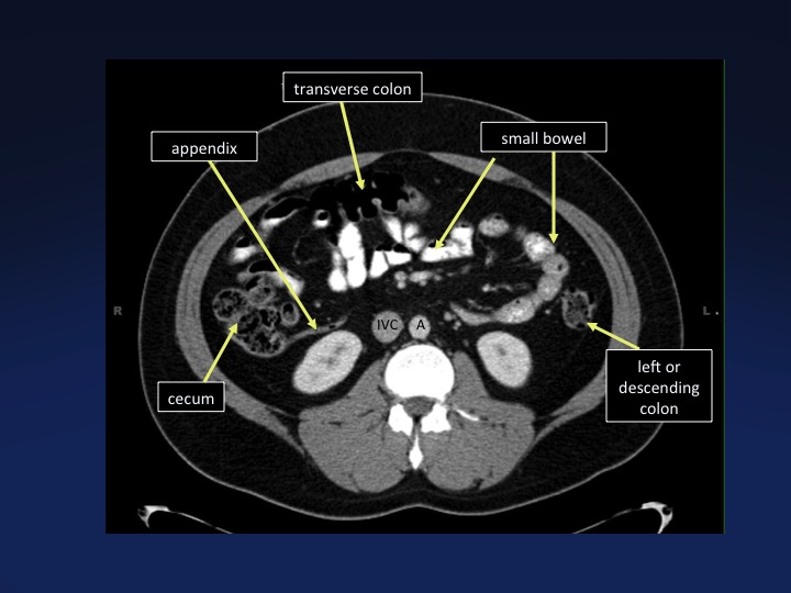 Cross Sectional Anatomy Of The Body MDCT Atlas CTisus CT Scanning Cross Sectional Anatomy Of The Body MDCT Atlas CTisus CT Scanning